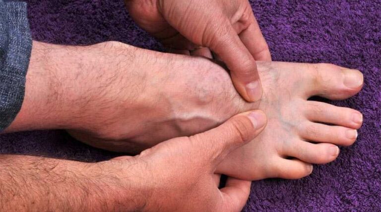 ¡Descubre las 5 razones sorprendentes por las que duele el empeine del ...